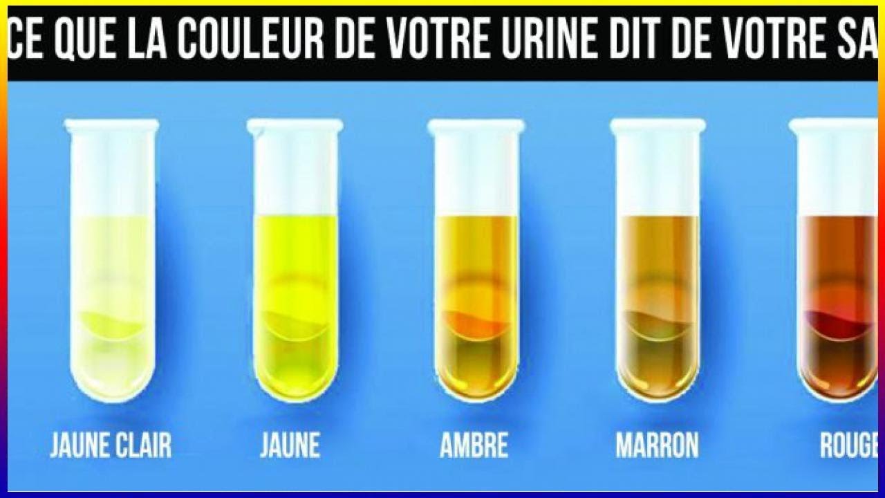 La couleur de votre urine révèle votre état de santé ⋆ Actuvision
